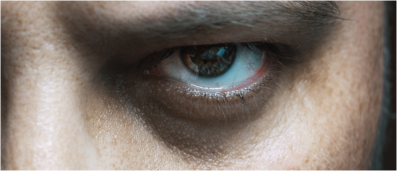 If your eye causes you to stumble - Where Peter Is